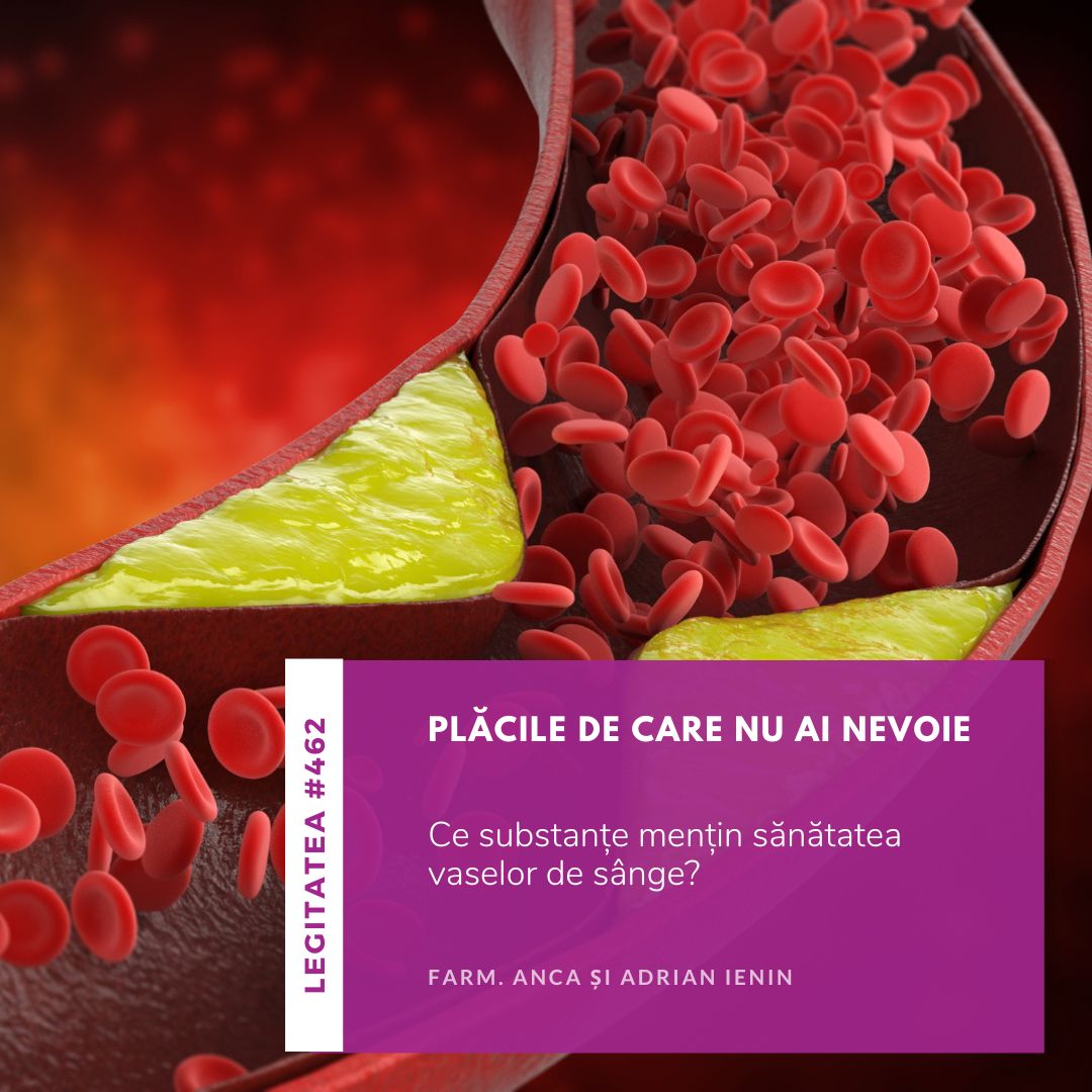 Plăcile de aterom, riscul de care nu ai nevoie (Legitatea #462 ...