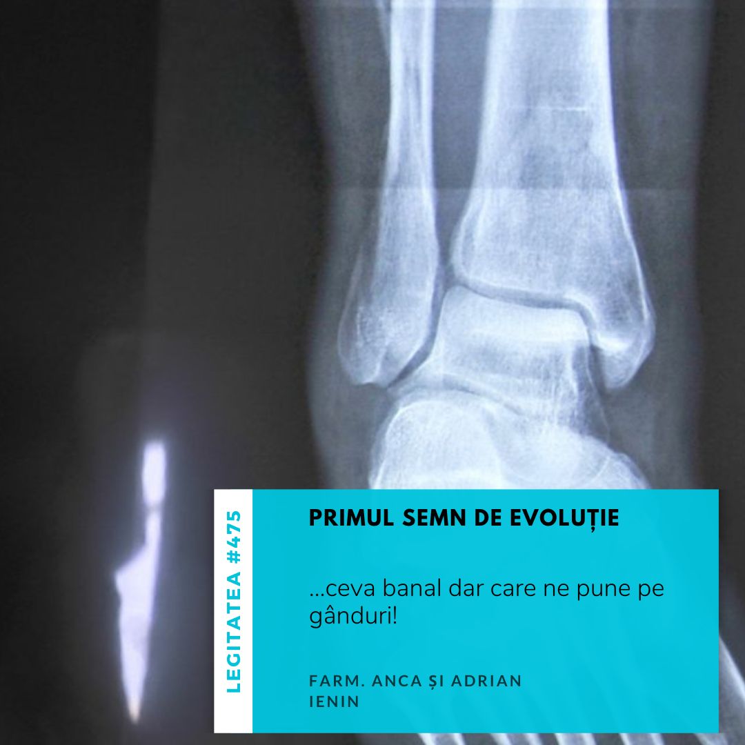 Primul semn de evoluție (Legitatea #475) - minuneanaturii.ro